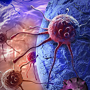 COMPASS: Can GI, GU Bleeding Predict New Cancer in Patients With ...