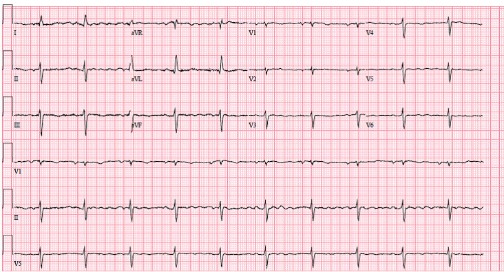 Searching for the Cause of HFpEF in Older Adults - American College of ...