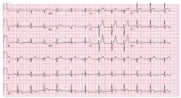Care of the Athletic Heart Patient Case Study Question - American ...