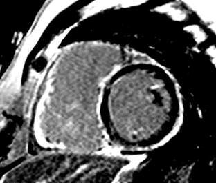 The Enhancement Pattern That Rings the Bell - American College of ...