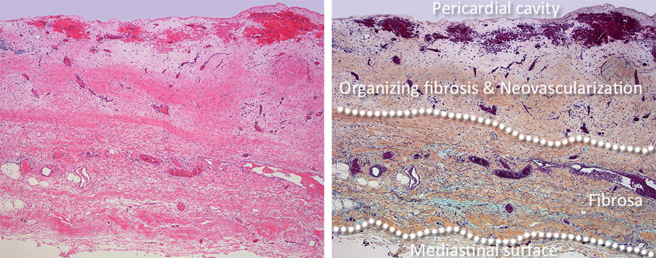 Visceral Pericardium Histology