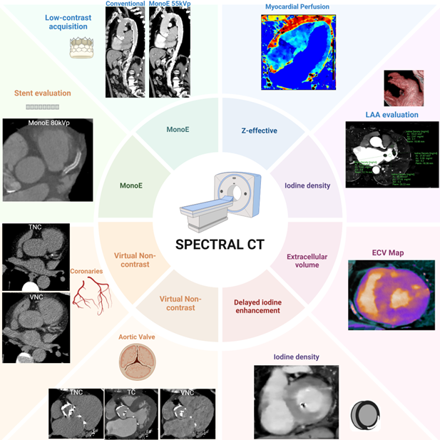 Multienergy Computed Tomography Imaging: Cardiovascular Applications ...