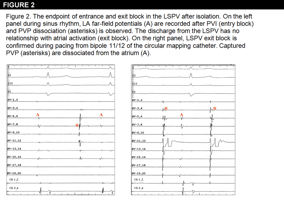 Ensuring Durable Pulmonary Vein Isolation - American College of Cardiology