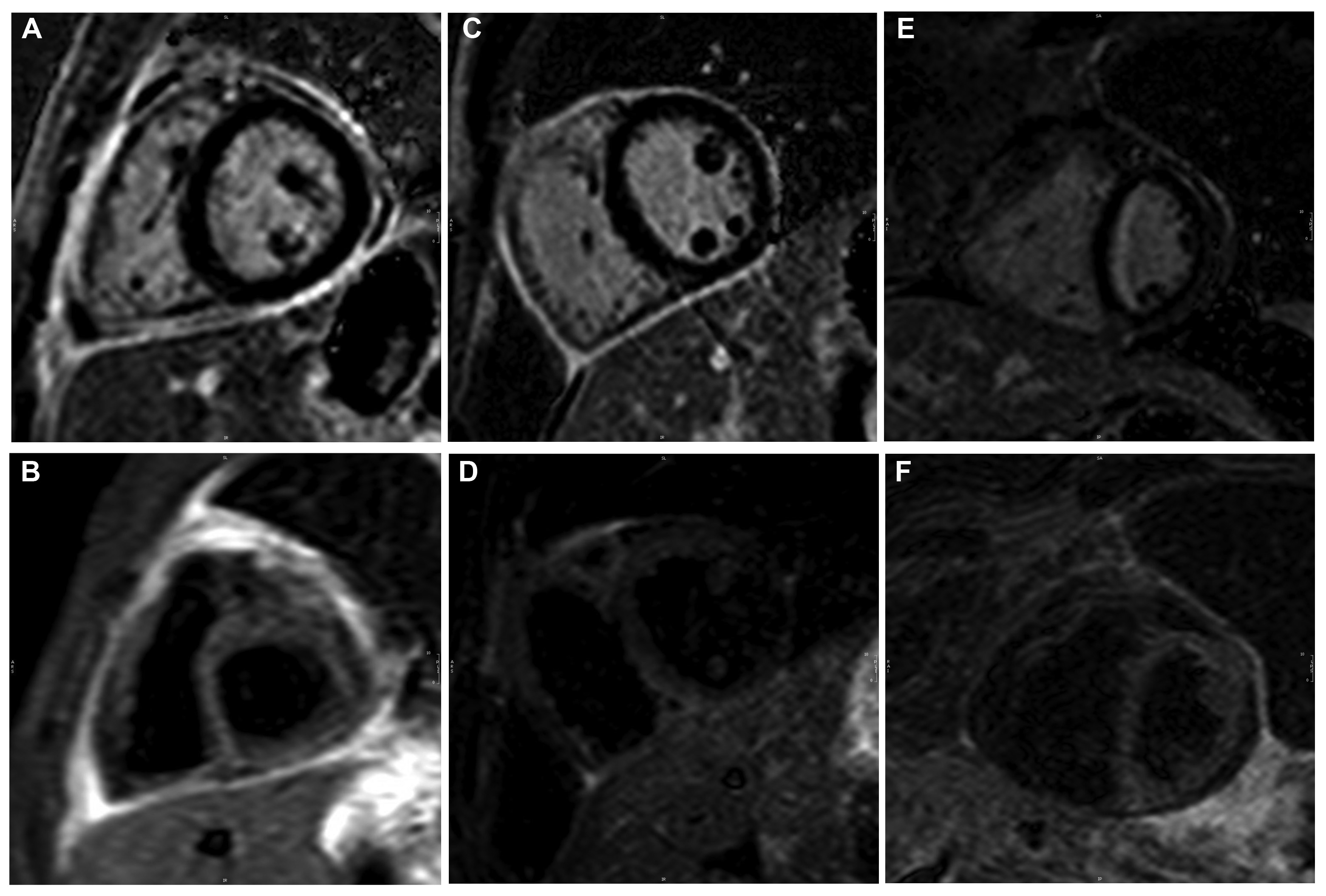 What Are the Indications for Cardiac Magnetic Resonance Imaging in ...
