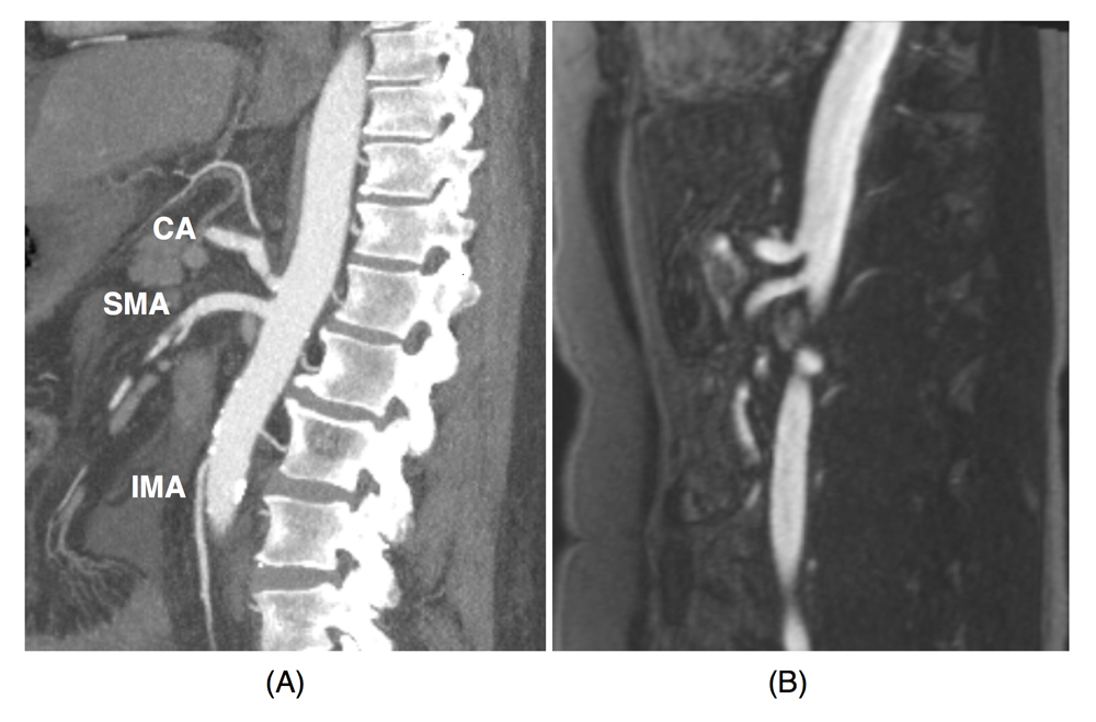 Inferior Mesenteric Artery Cat Guidelines For The Measurement Of
